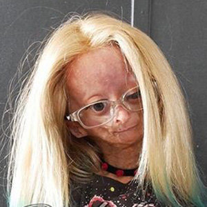 Adalia Rose Wiki, Age, Death, Parents, Net Worth Details